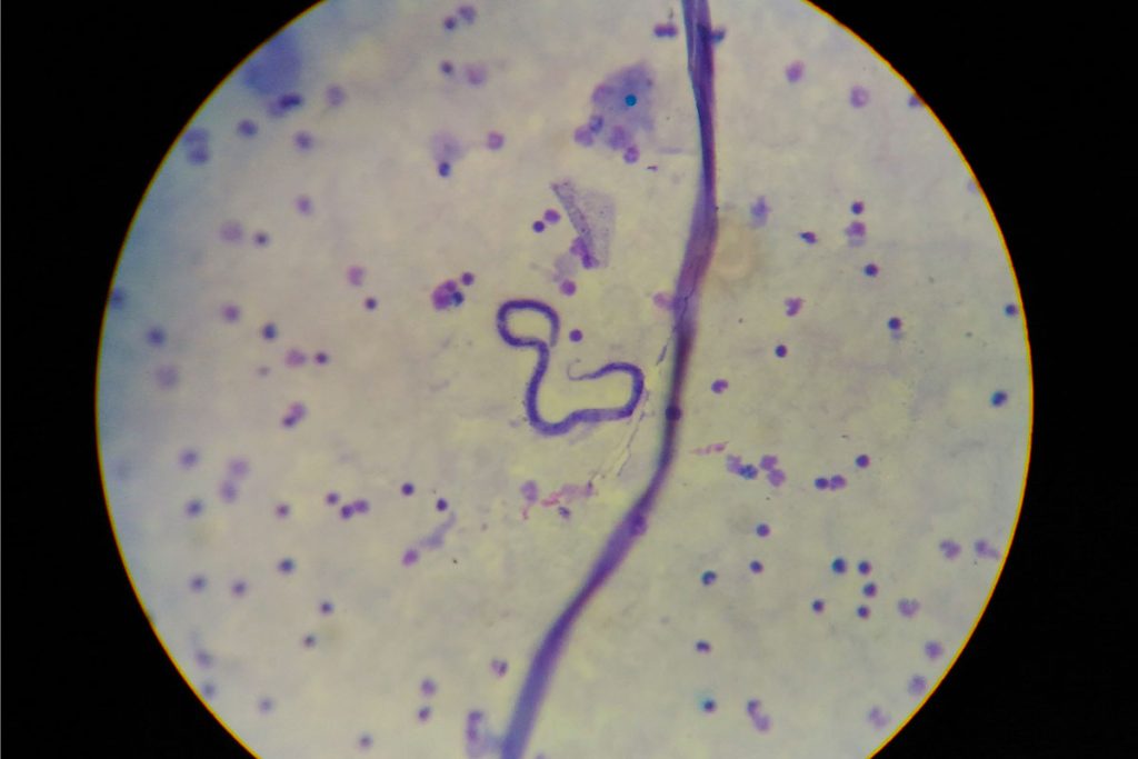 Fundación Carlos Slim participa en la eliminación de la oncocercosis en ...